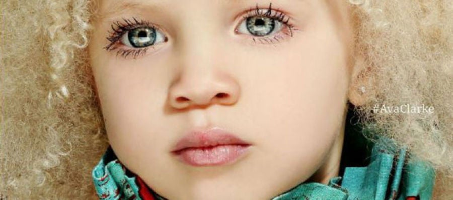 Ava Clarke, la pequeña albina afroamericana que conquista el mundo de ...