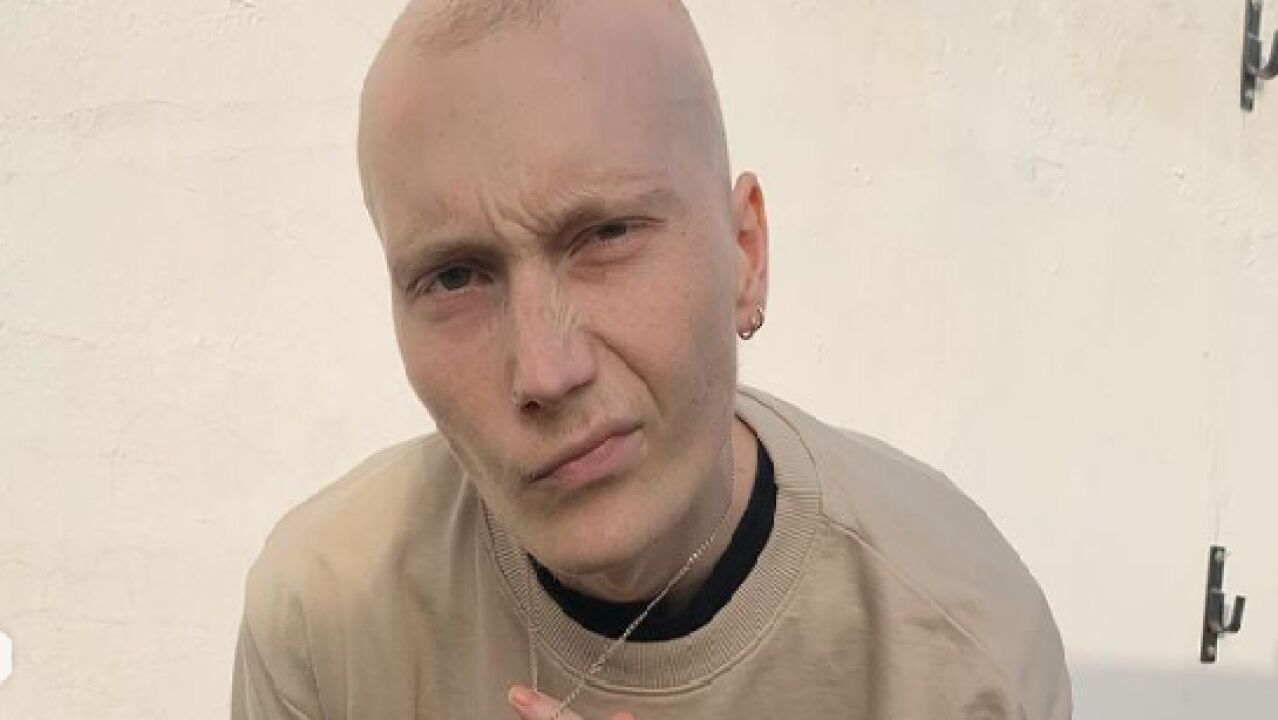 Muere Charlie, el 'tiktoker' de 20 años que se convirtió en un ...